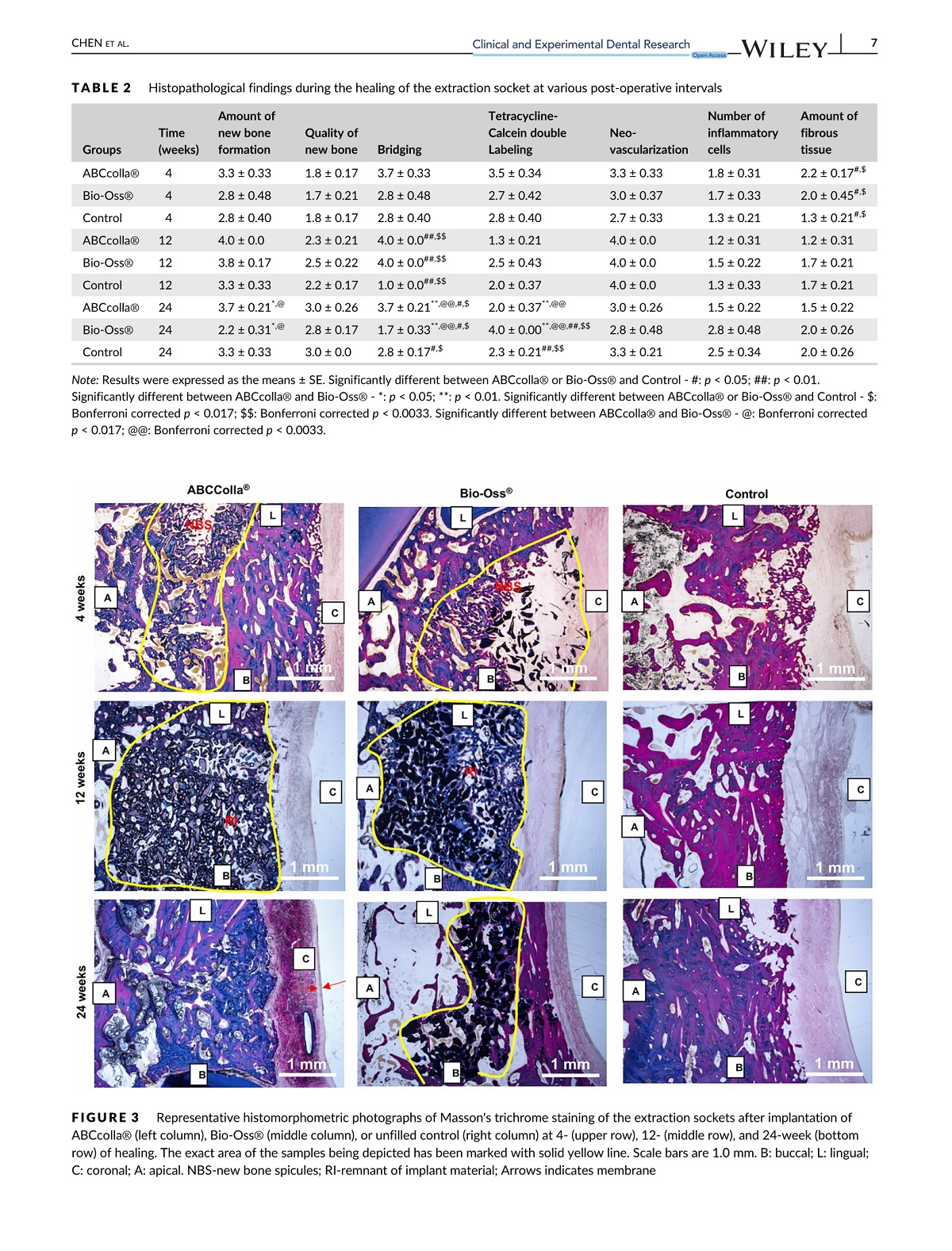 Evaluating the bone-regenerative role of the decellularized porcine ...