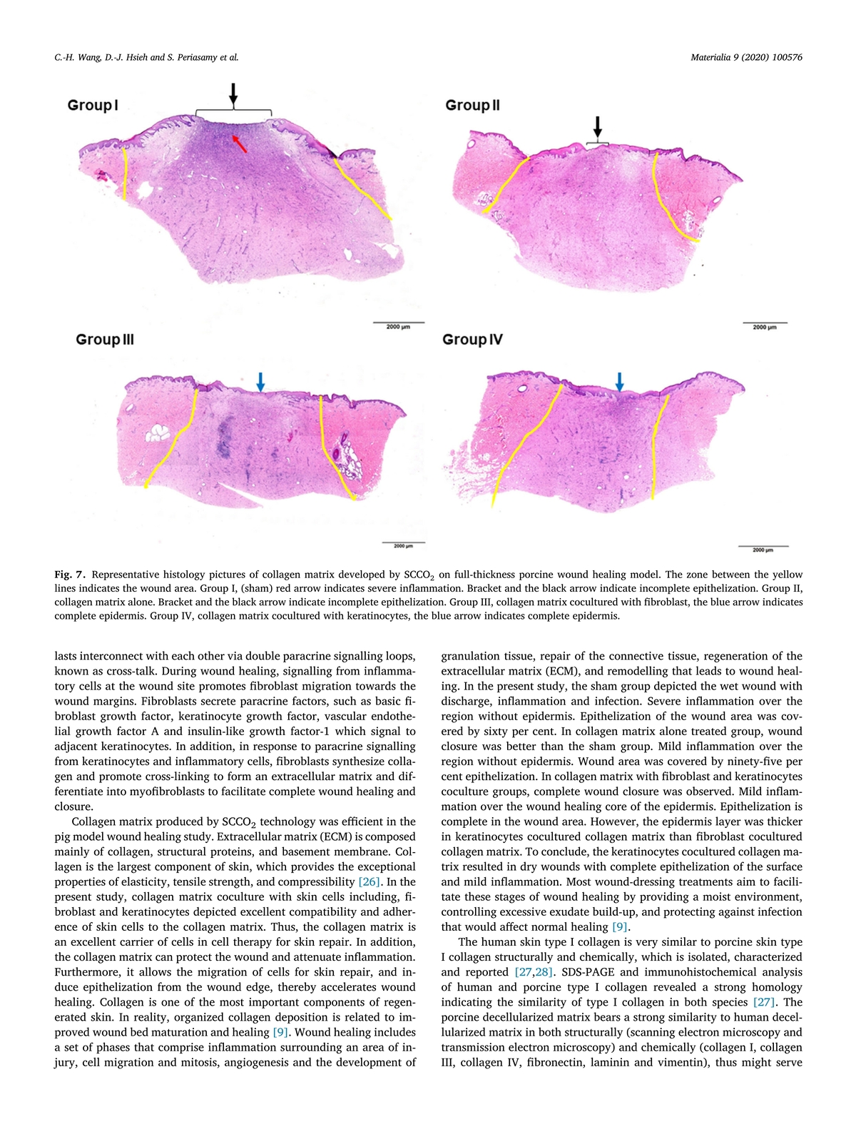 Regenerative porcine dermal collagen matrix developed by supercritical ...